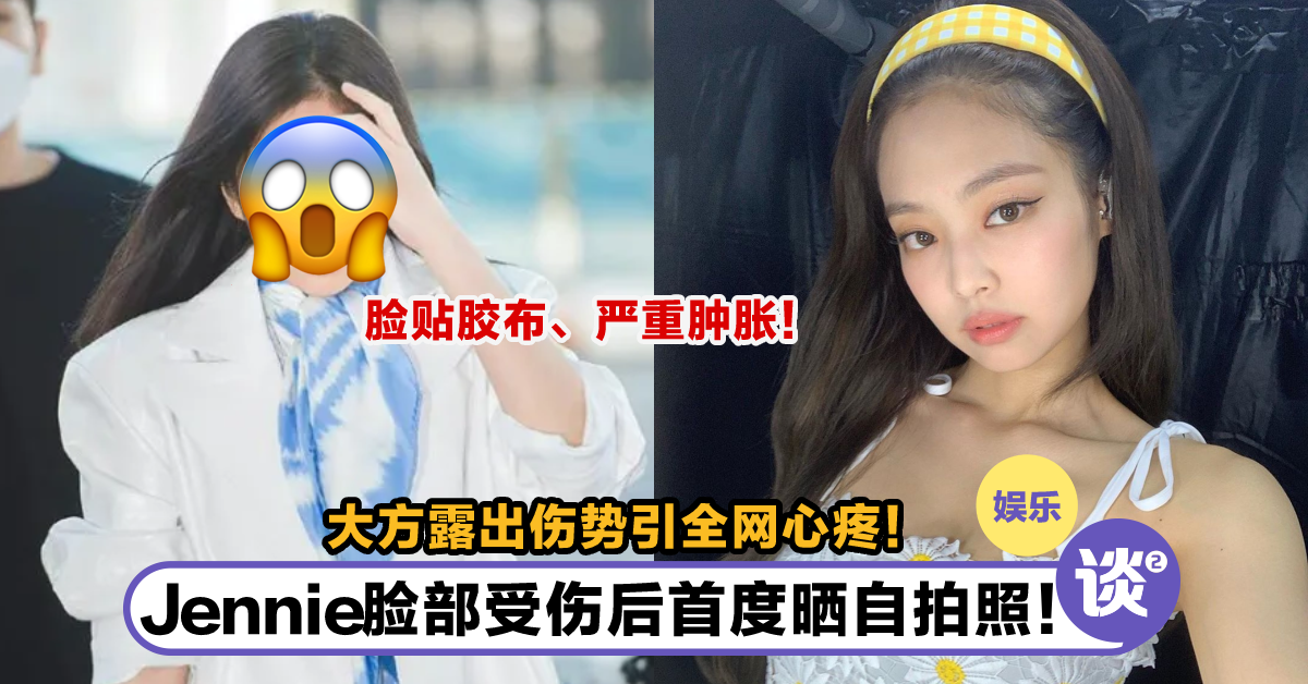 Jennie首度晒出破相照！精致脸蛋「严重肿胀」吓坏粉丝！【内有影片】 | TTN 谈谈网